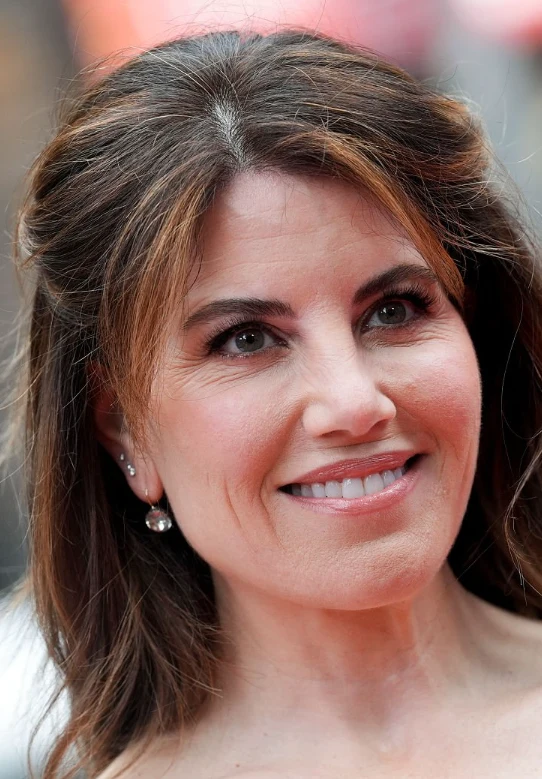 Monica Lewinsky Then and Now - Teeth Transformation | LEMA