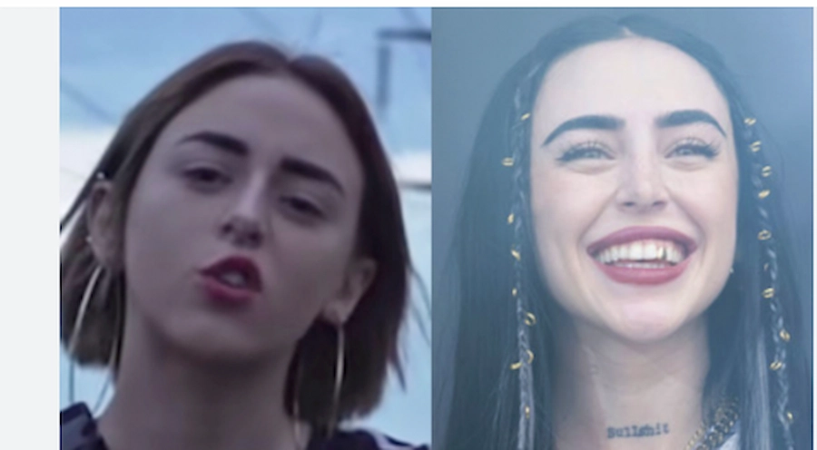 🎵 Nicki Nicole Zęby (Stare/Nowe): Zdjęcia Przed i Po