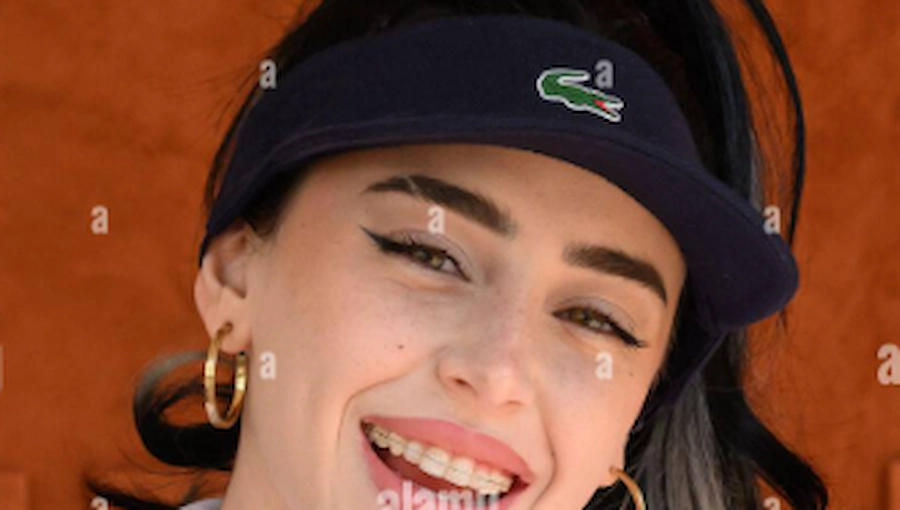 🎵 Nicki Nicole Dents (Anciennes/Nouvelle) : Photos Avant et Après ...