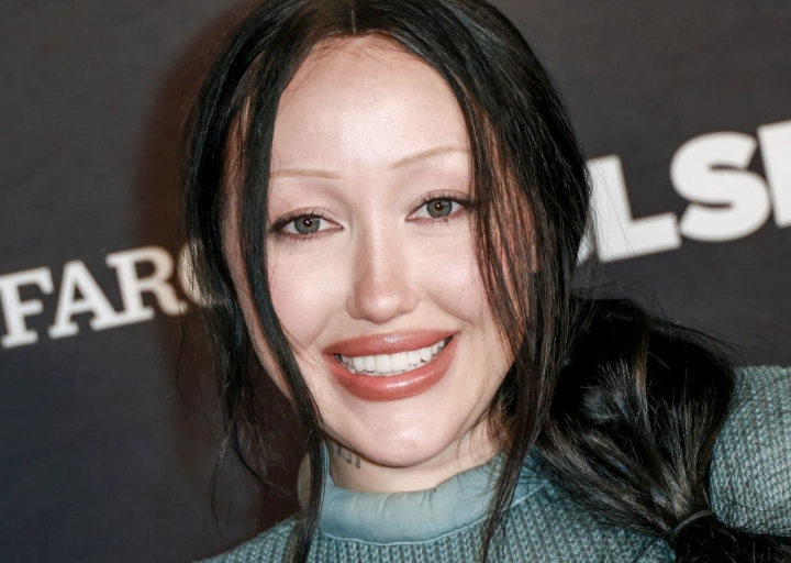 Noah Cyrus's Teeth: Before and After | LEMA