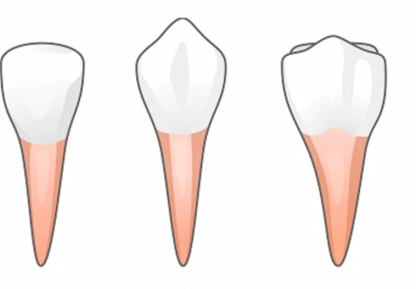 🦷What Are Premolar Teeth and Why Are They Important? | LEMA