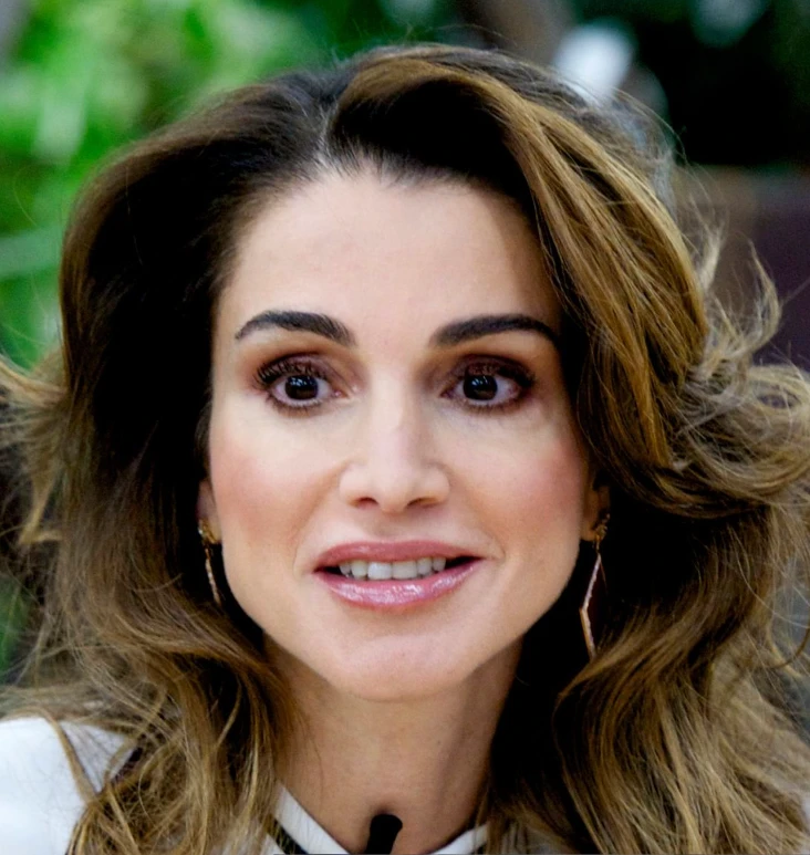 The Queen’s Smile – Rania of Jordan’s Teeth Before & After | LEMA