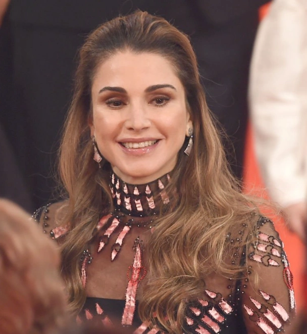 The Queen’s Smile – Rania of Jordan’s Teeth Before & After | LEMA