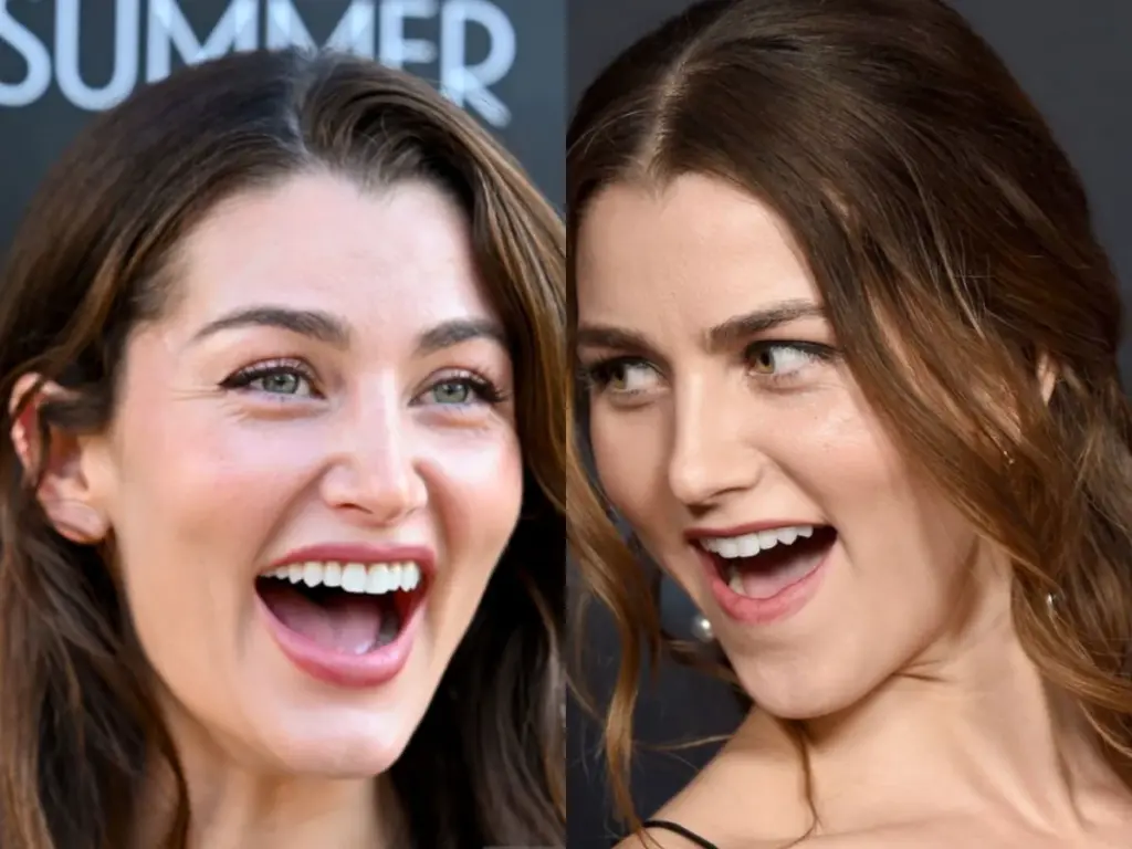 Rachel Matthews' Stunning Teeth Transformation: Before and After | LEMA