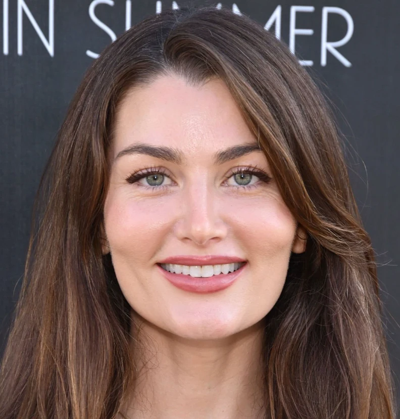 Transformarea impresionantă a dinților Rachel Matthews | Lema Dental Clinic