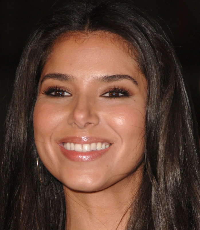 Защо Розелин Санчес оправи зъбите си