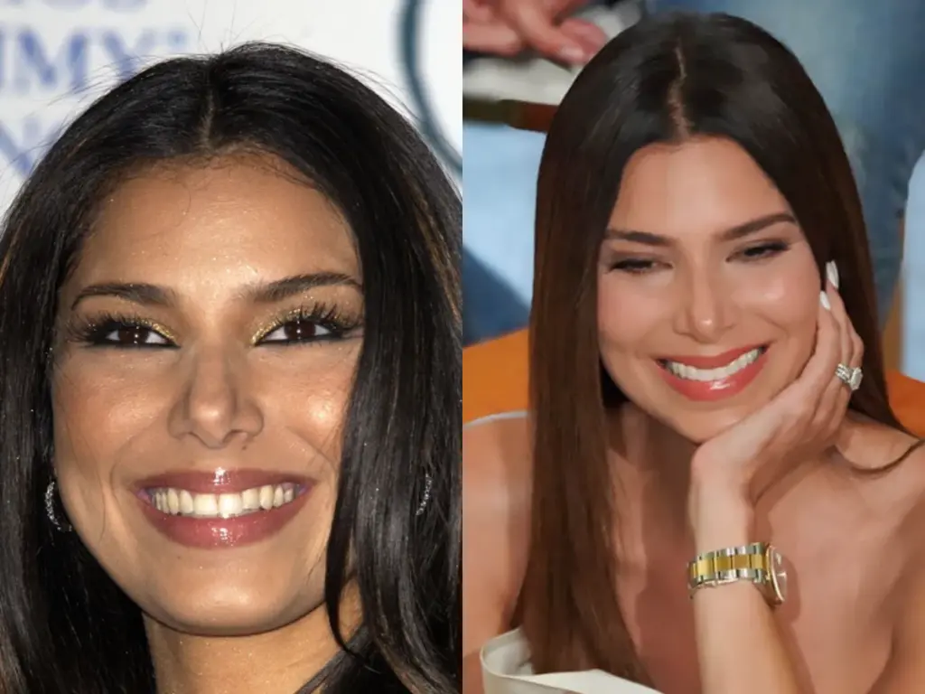 Warum hat Roselyn Sánchez ihre Zähne richten lassen | Lema Dental Clinic