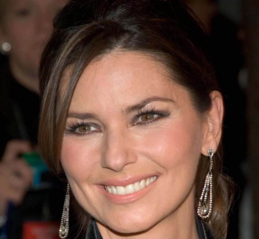 🤩 De iconische tandentransformatie van Shania Twain