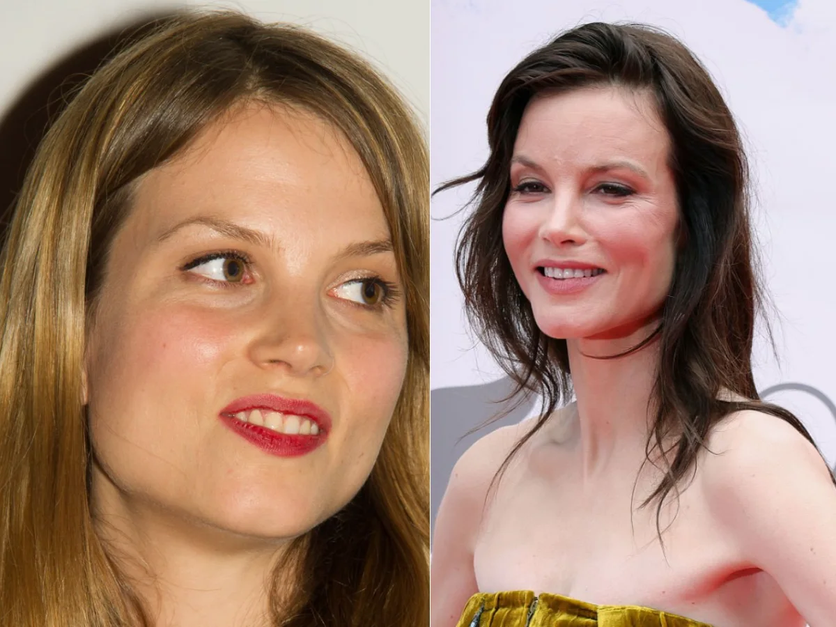 🦷 Häufige Symptome von Weisheitszähnen