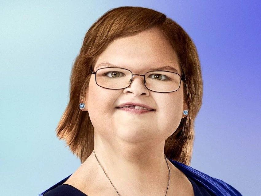 🦷What Causes Pain After a Tooth Filling? | LEMA