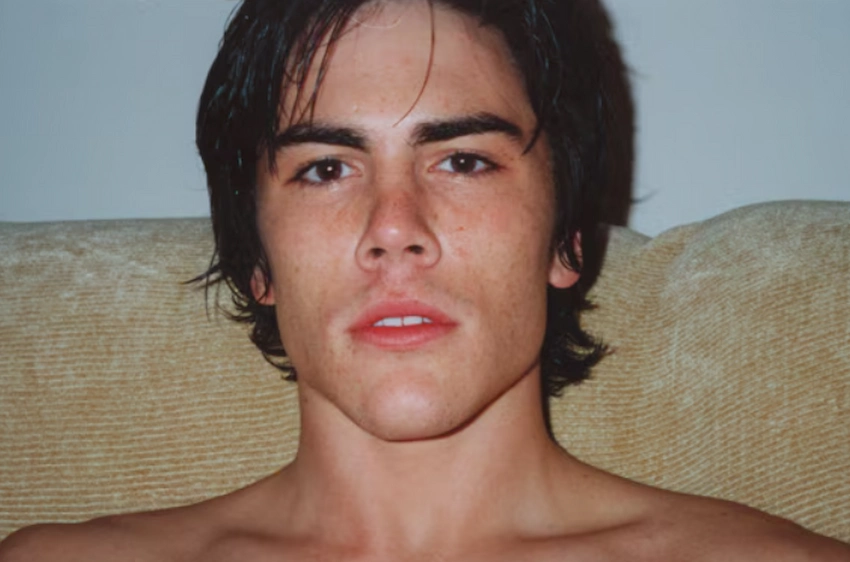 🤩 Tom Sandoval Tænder (Gamle/Nye): Før og efter