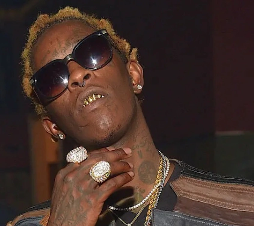 Young Thug Teeth (Old/New): Before and Afters | LEMA