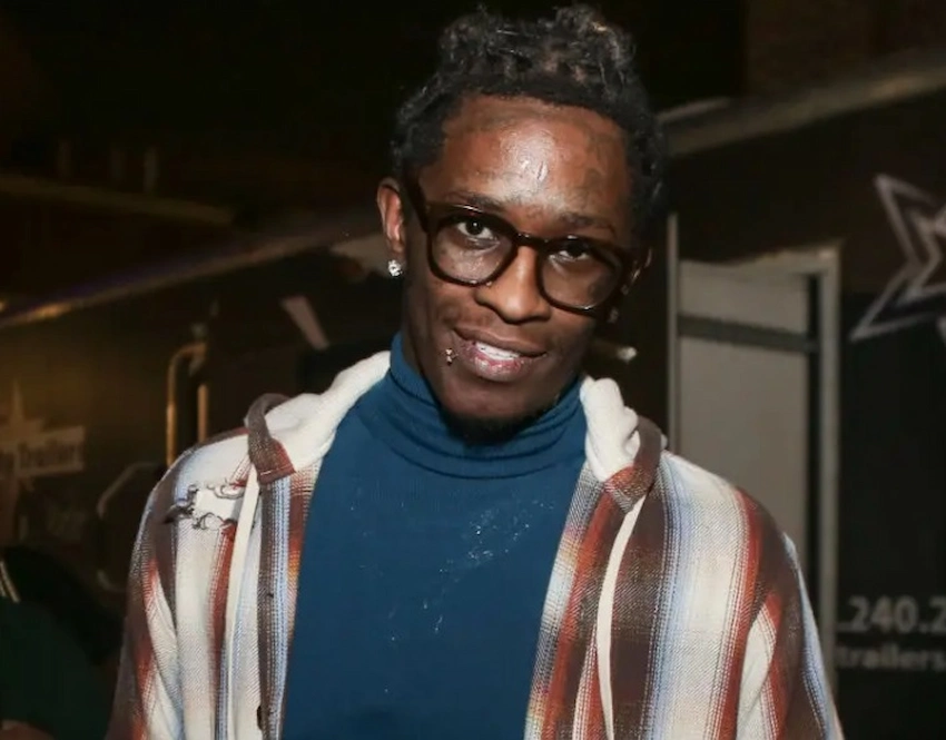 Young Thug Teeth (Old/New): Before and Afters | LEMA