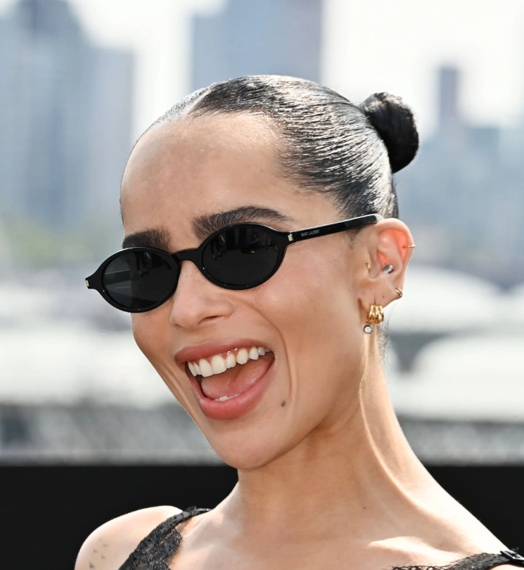🤩 Zoe Kravitz’s New Teeth in 2025 – Stunning Effect | LEMA