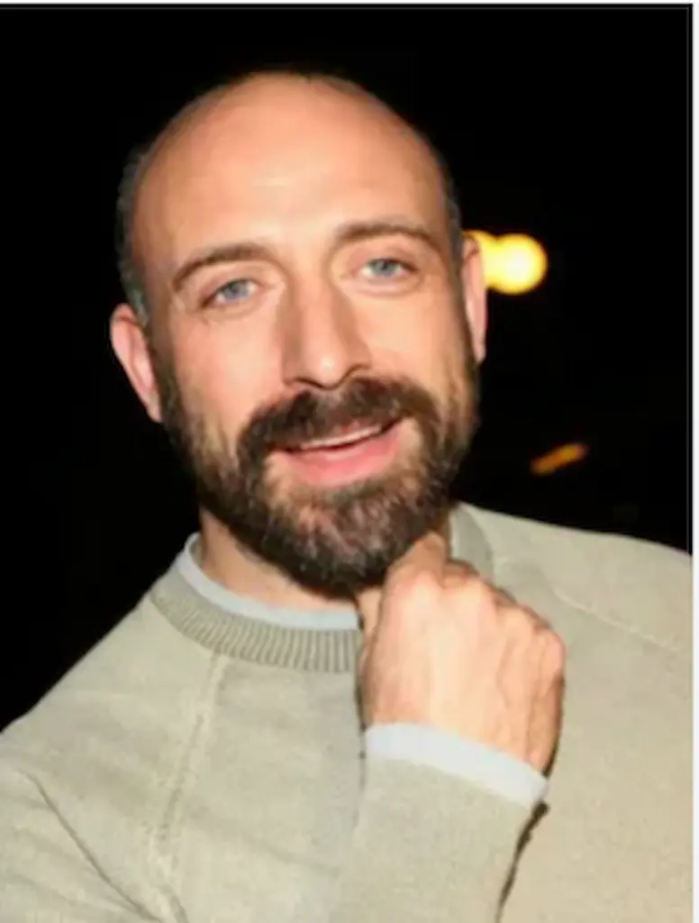 💎 Halit Ergenç Teeth:Before and After Teeth Transformation! | LEMA