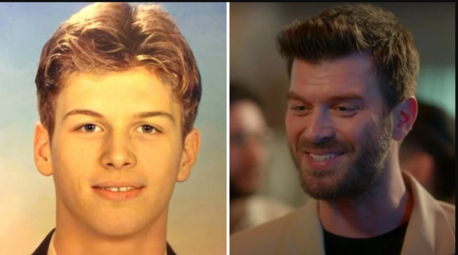 What Is British Teeth? How to Achieve a Beautiful Smile | LEMA