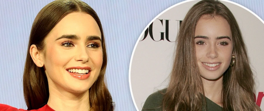 Lily Collins tenner (gammelt/nytt): Før og etter