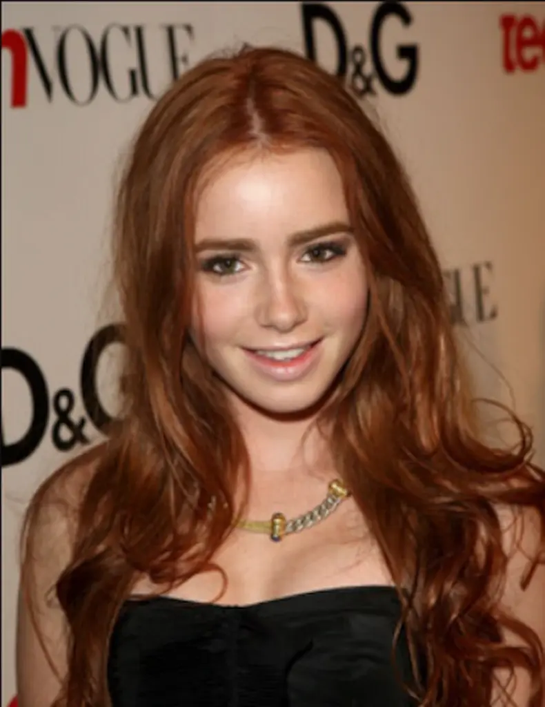 Зъбите на Lily Collins (стари/нови): Преди и след