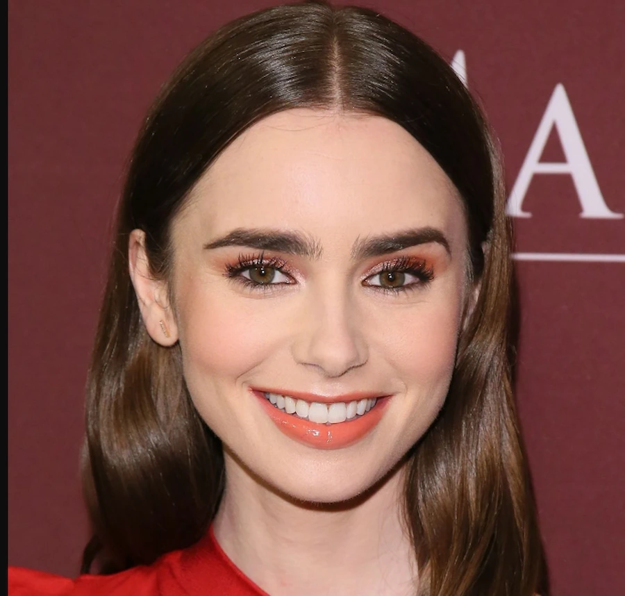 Dişler von Lily Collins (eski/yeni): Önce ve sonra | Lema Dental Clinic
