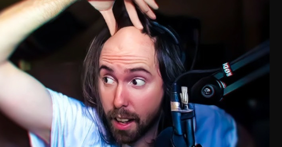 👨‍💻 Asmongold Dents Vieux/Nouveaux : Avant / Après ! A-t-il eu des ...