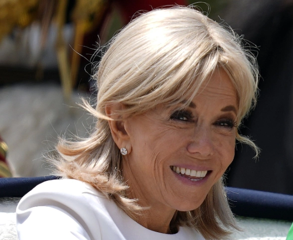 Brigitte Macron's Teeth Transformation (Old/New): Before and After | LEMA
