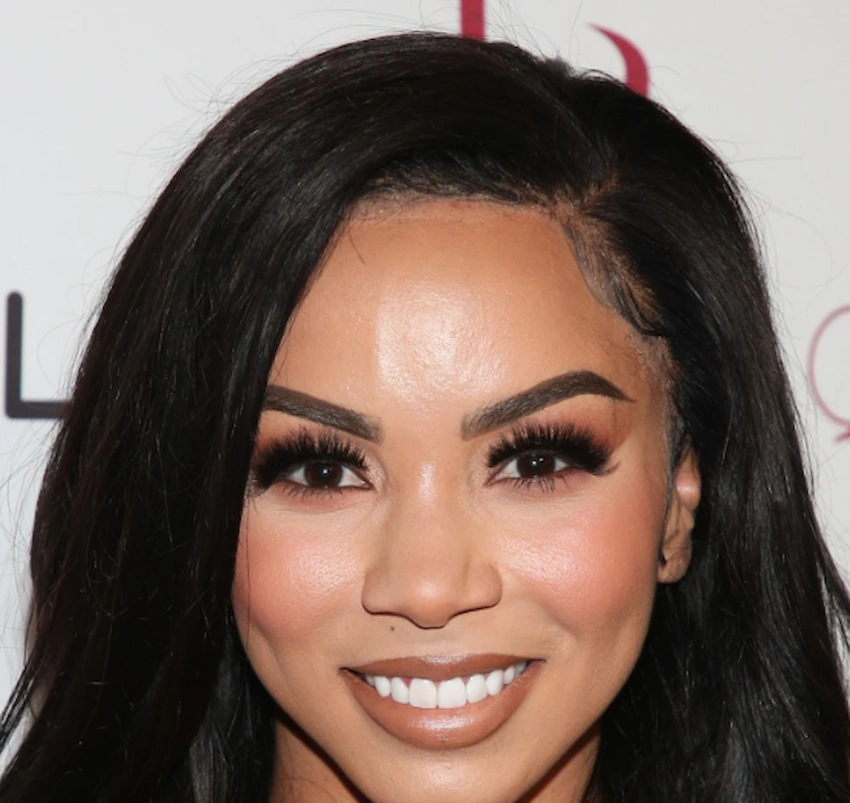 🤩 Brittany Renner'ın Diş Dönüşümü: Öncesi ve Sonrası | Lema Dental Clinic