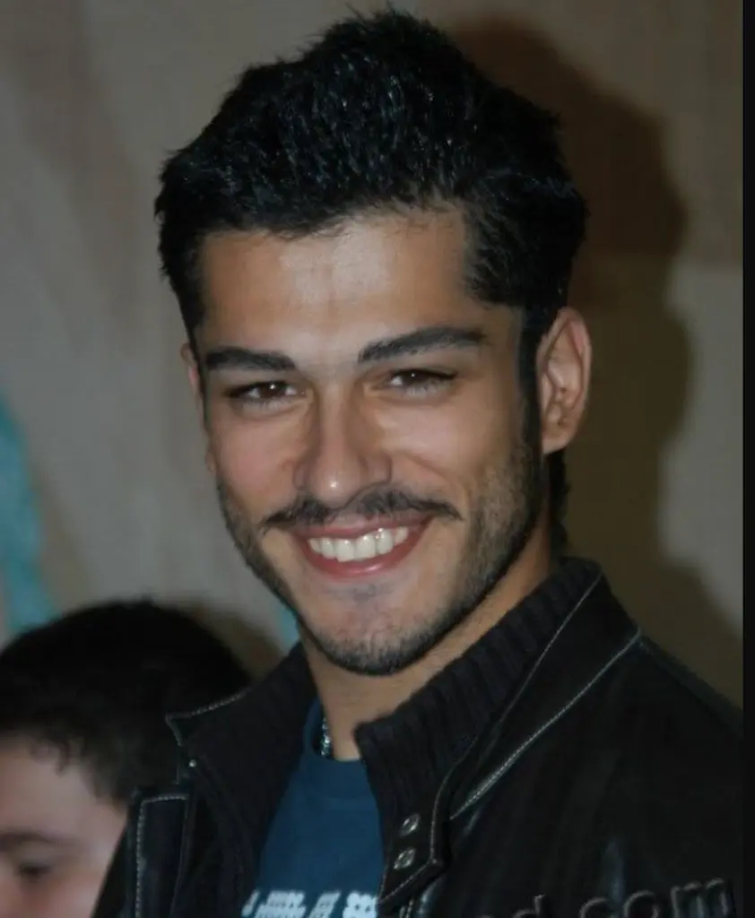 ⭐ The Smile of Burak Özçivit: Teeth Before/After! | LEMA
