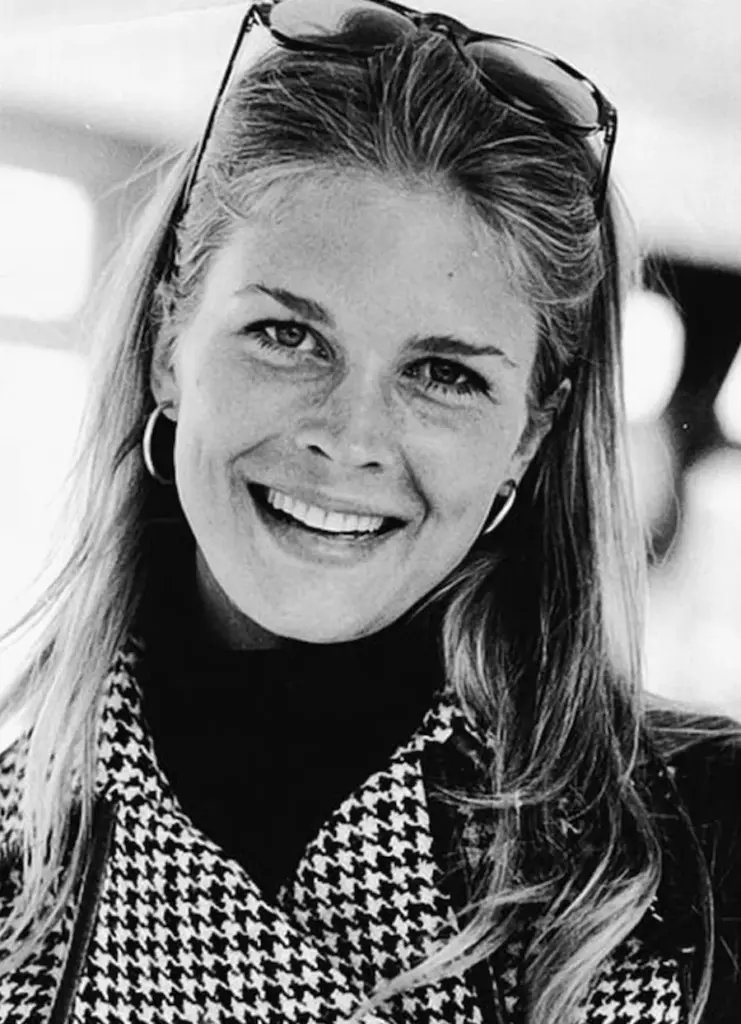 📺 Candice Bergen Tænder (Gamle/Nye): Før og efter
