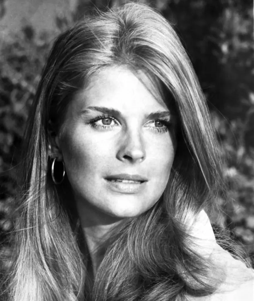 📺 Candice Bergen Tänder (Gamla/Nya): Före och Efter