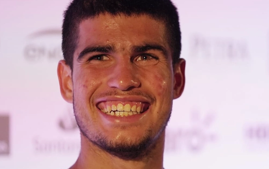 Verwandlung der Zähne von Carlos Alcaraz: Vorher und Nachher | Lema ...