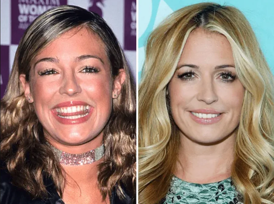 👸 Kate Middleton’s Teeth: A Royal Transformation | LEMA