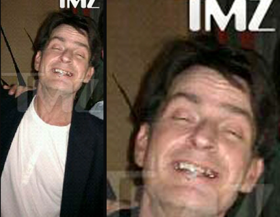 Charlie Sheen Teeth (Old/New): Before and Afters! | LEMA