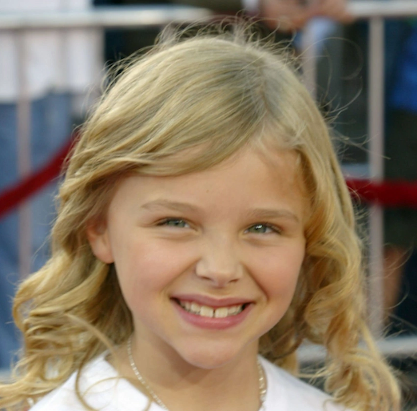 👩 Chloe Grace Moretz Tannleger (Gamle/Nye): Før og etter