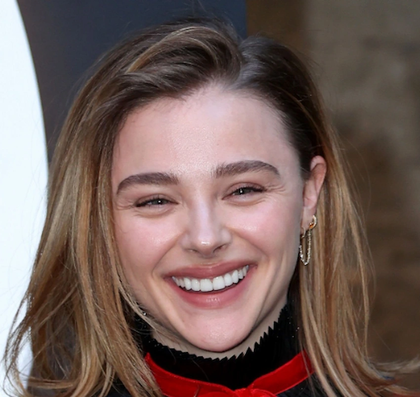 👩 Chloe Grace Moretz Tannleger (Gamle/Nye): Før og etter
