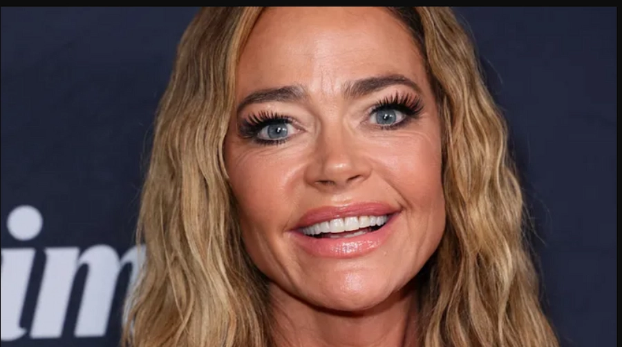 👱‍♀️ Denise Richards Teeth (Old/New): Before and Afters! | LEMA