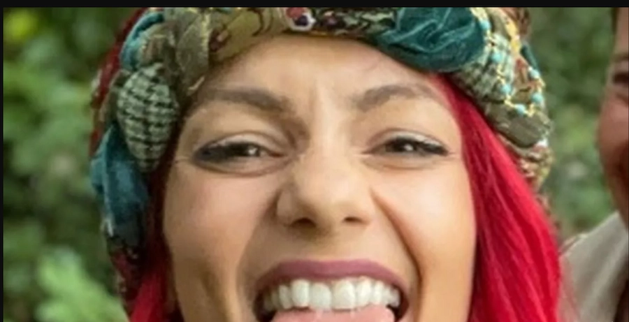 Dianne Buswell Teeth (Old/New): Before and Afters! | LEMA