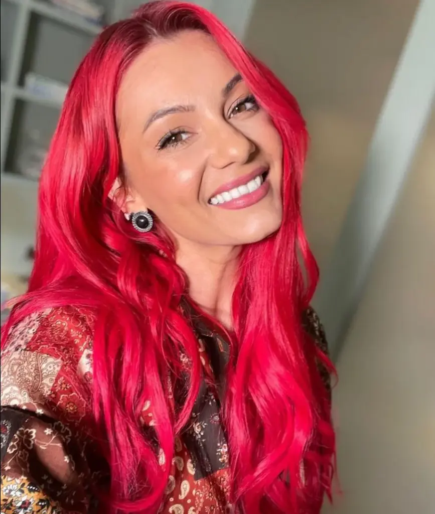 Dianne Buswell Teeth (Old/New): Before and Afters! | LEMA
