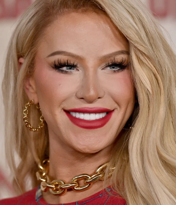 La transformación de sonrisa de Gigi Gorgeous | Lema Dental Clinic