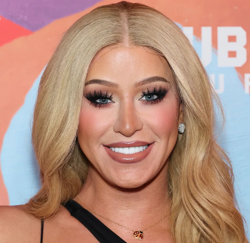 La transformación de sonrisa de Gigi Gorgeous | Lema Dental Clinic