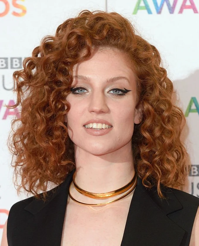 La nueva sonrisa de la cantante Perfect Jess Glynne | Lema Dental Clinic