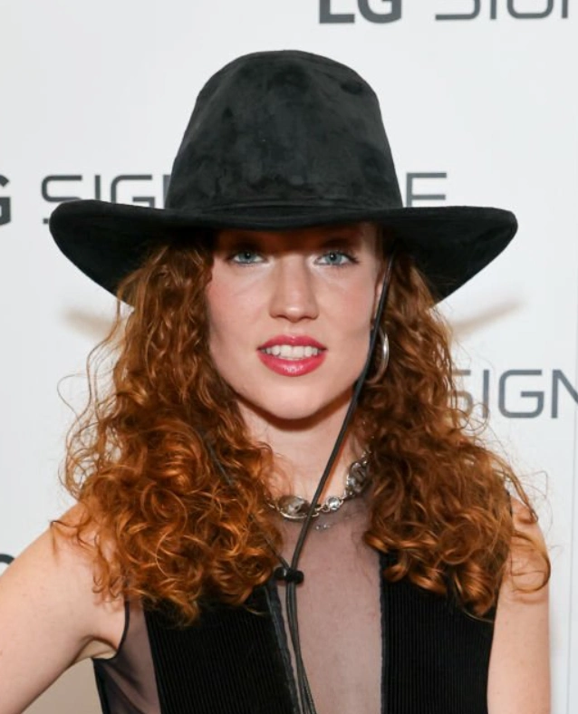 La nueva sonrisa de la cantante Perfect Jess Glynne | Lema Dental Clinic