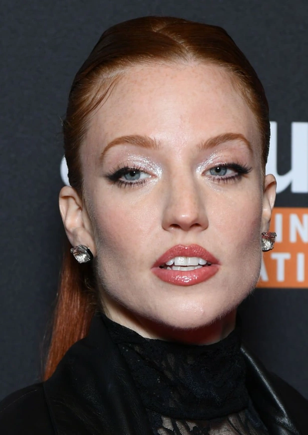 La nueva sonrisa de la cantante Perfect Jess Glynne | Lema Dental Clinic