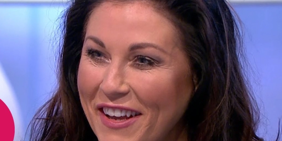 🎭 Jessie Wallace Teeth (Old/New): Before and Afters! | LEMA