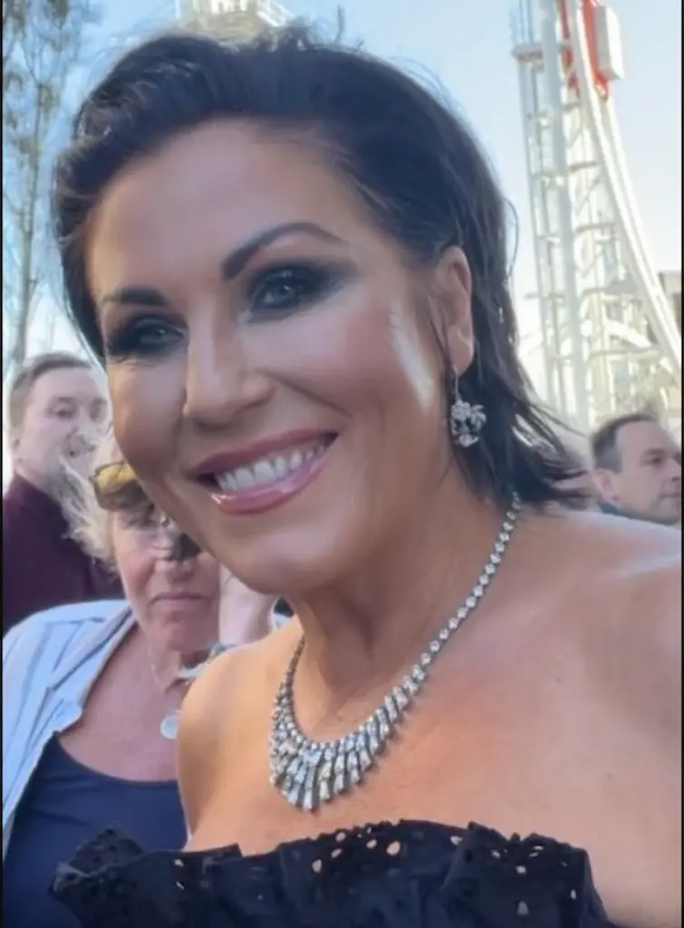 🎭 Jessie Wallace Teeth (Old/New): Before and Afters! | LEMA