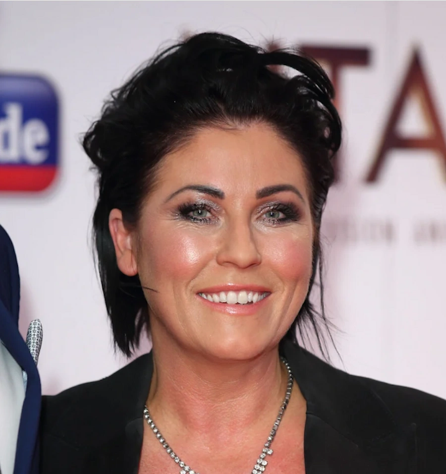 🎭 Jesse Wallace dents (anciennes/nouvelles) : Avant et après | Lema Dental Clinic