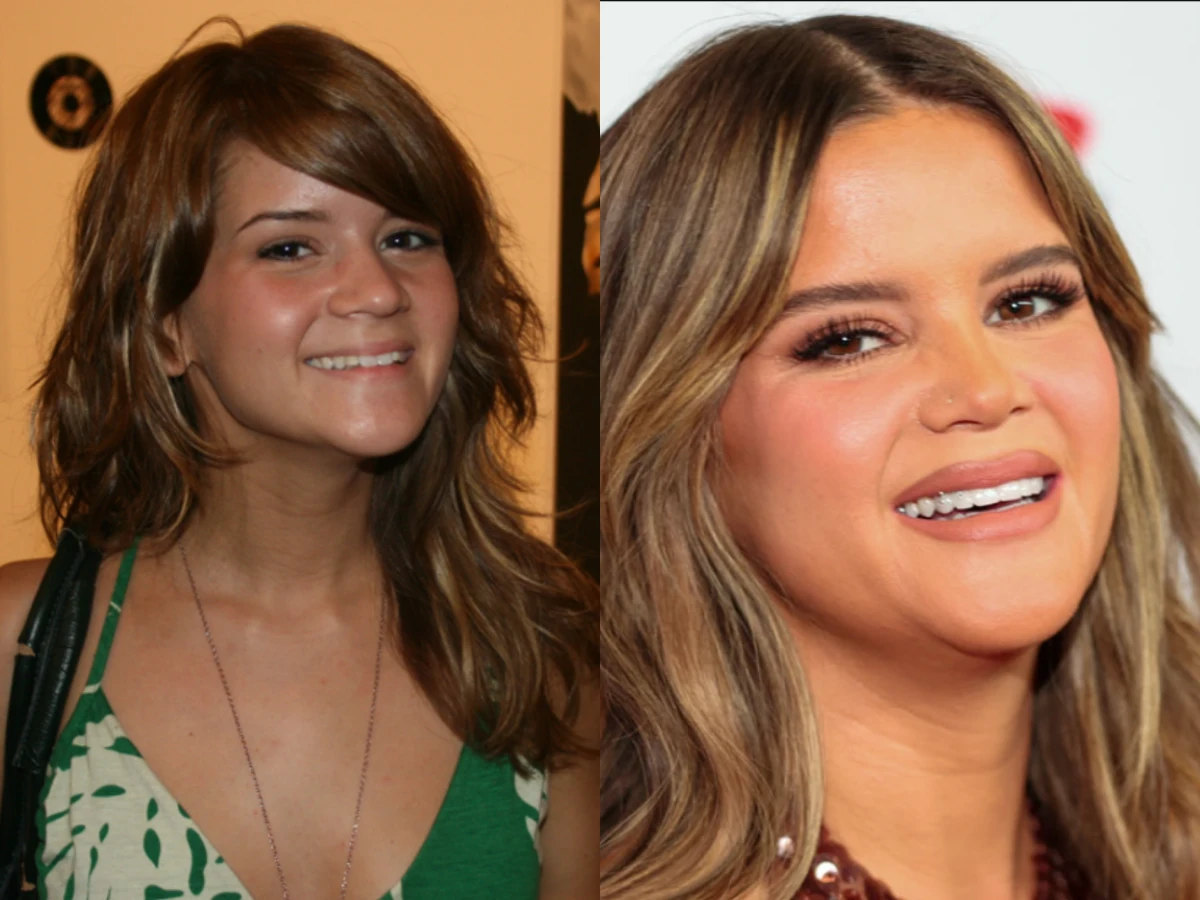 Transformación dental de Maren Morris - Antes y después | Lema Dental ...