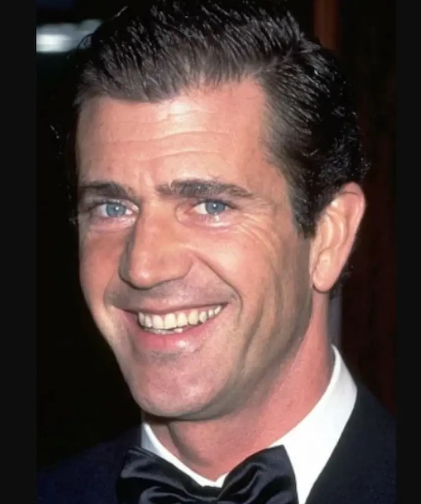 Mel Gibson’s Teeth Smile Evolution: Before/After Dental! | LEMA