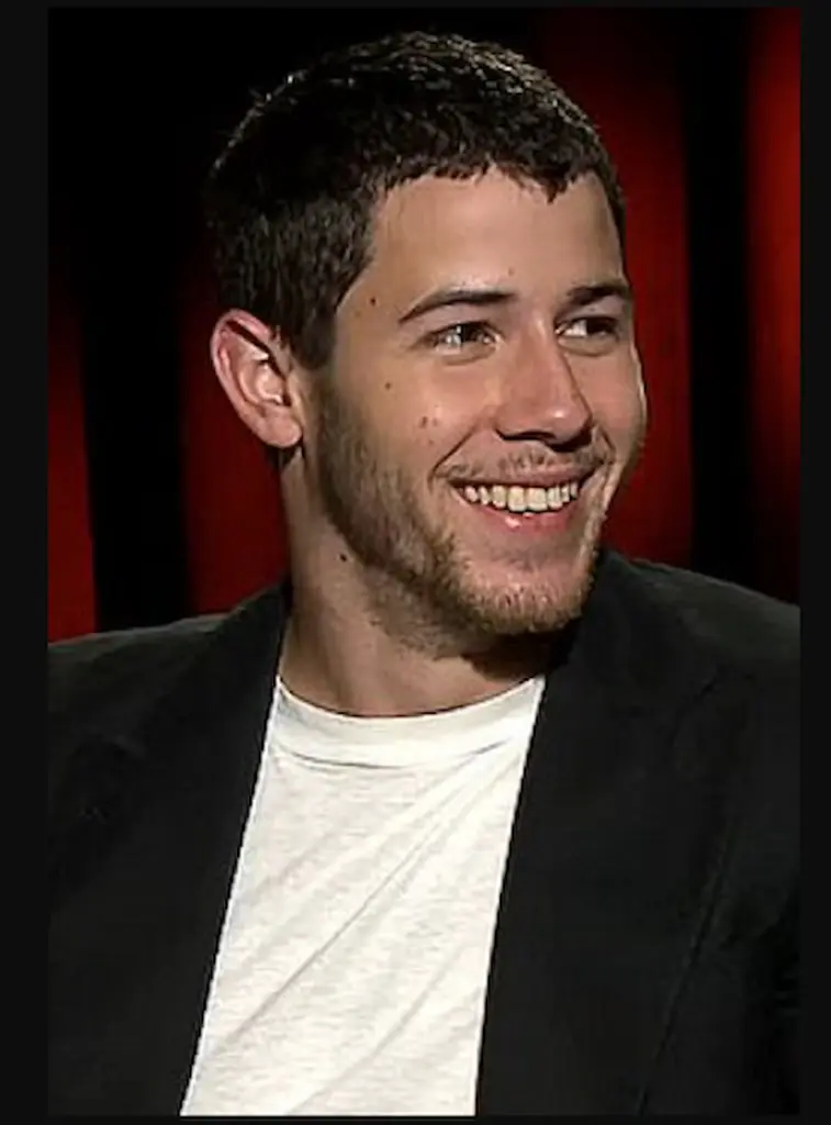 🎶 Nick Jonas’ Front Teeth Transformation: Before and After! | LEMA