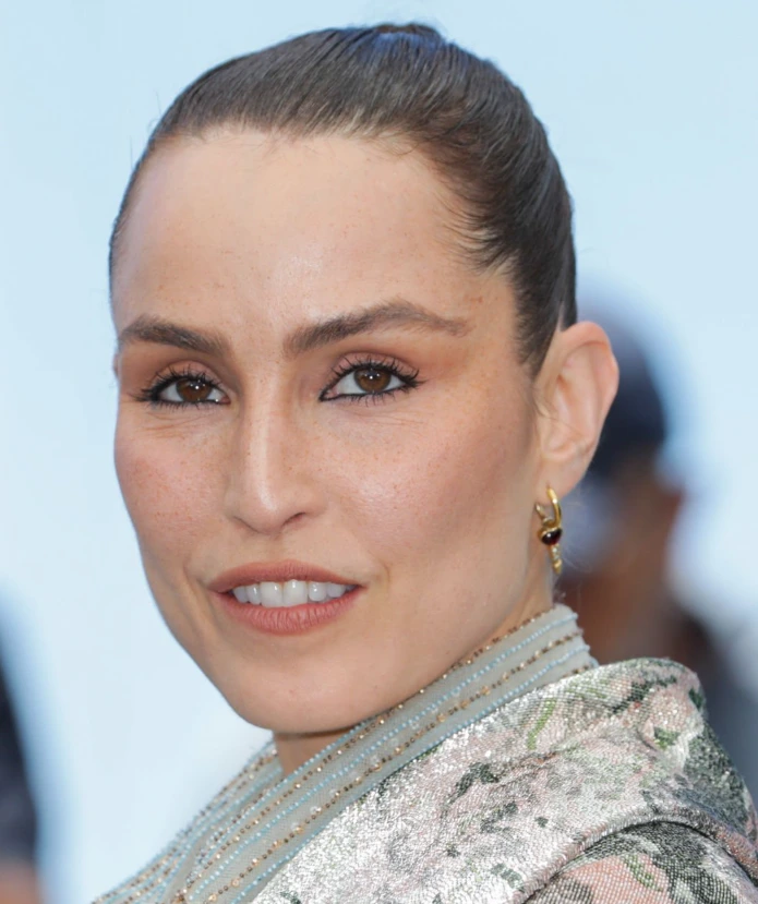 Transformacja uśmiechu Noomi Rapace: przed i po