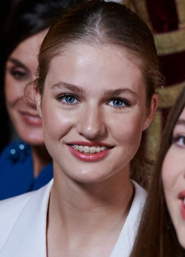 Transformation dentaire de la princesse Leonor : Avant et après | Lema ...